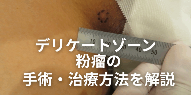 目のまわりにできる粉瘤（ふんりゅう）とは？部位別の特徴・原因・治療法まで専門医が徹底解説 北海道皮膚のできものと粉瘤クリニック古林形成外科