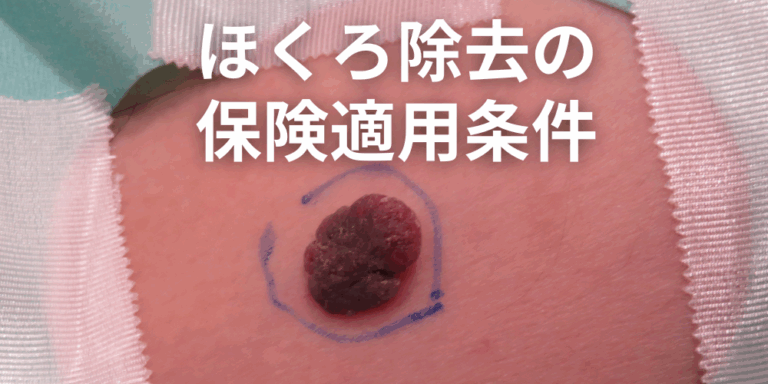 投稿 北海道皮膚のできものと粉瘤クリニック古林形成外科 札幌院｜中央区大通にて皮膚悩みを土日祝も対応【皮膚科・形成外科】